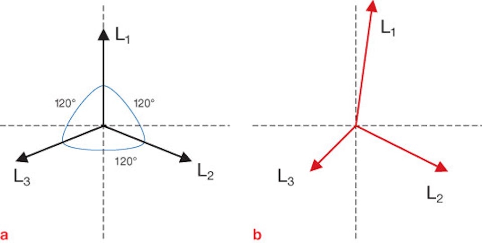 Introductie asymmetrieproblemen